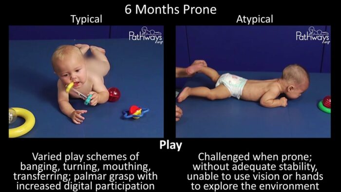 Pathways.org | 6 Month Old Typical/Atypical Motor Development – Side by ...